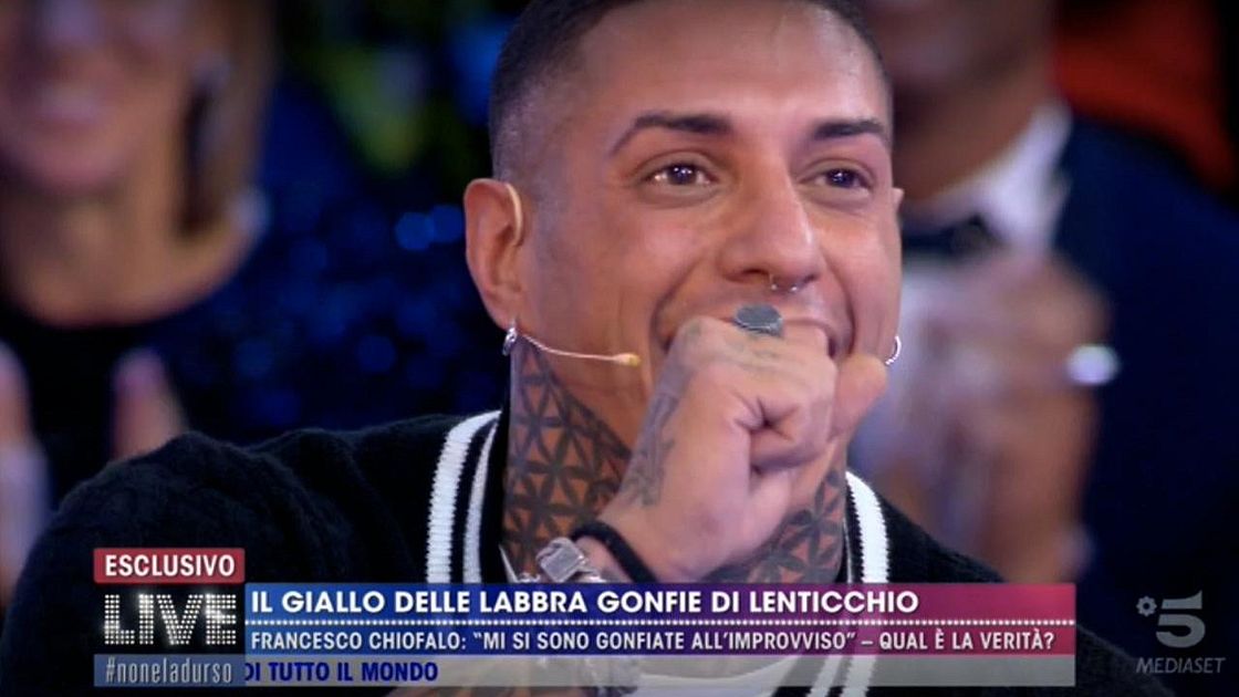Lenticchio: "Le labbra si sono gonfiate per un'allergia" | Mediaset ...